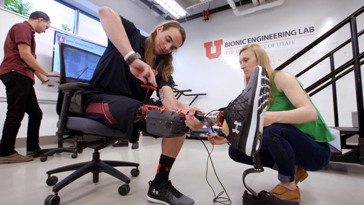 How Bionics are Redefining the Future of Prosthetics